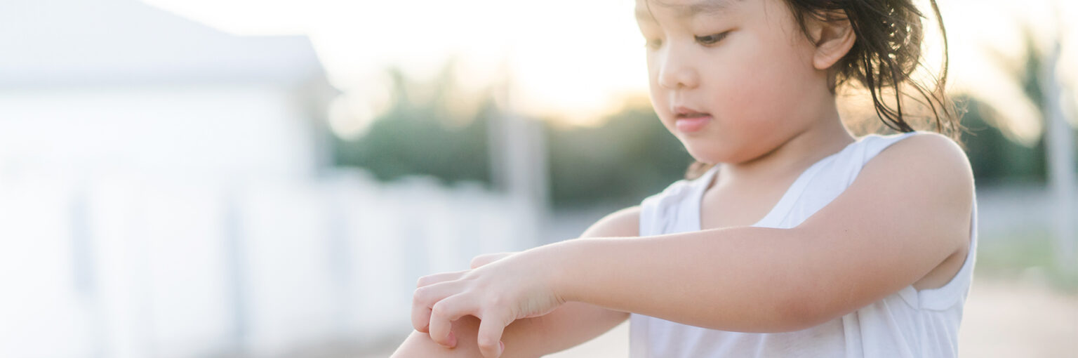 Eczema in Children: Causes, Symptoms and Treatment - Welcome to ...